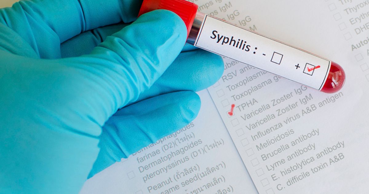 Soa-poli Amsterdam weigert 2.600 mensen | Radar - het ...