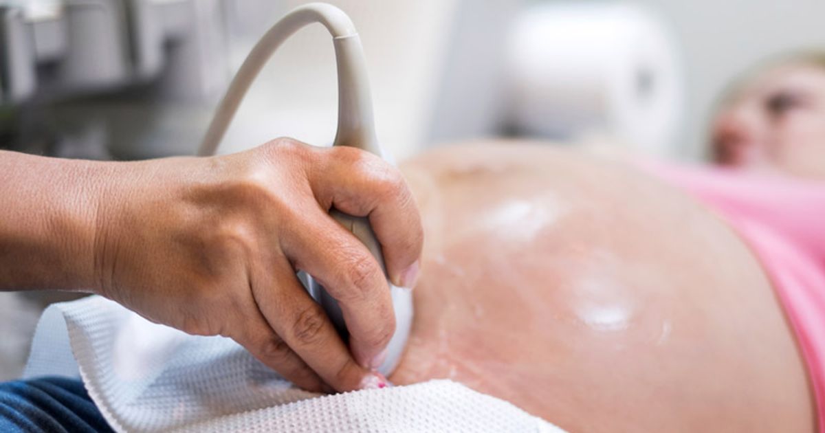 3D-printer kan mogelijk helpen bij behandeling open ruggetje | Radar ...